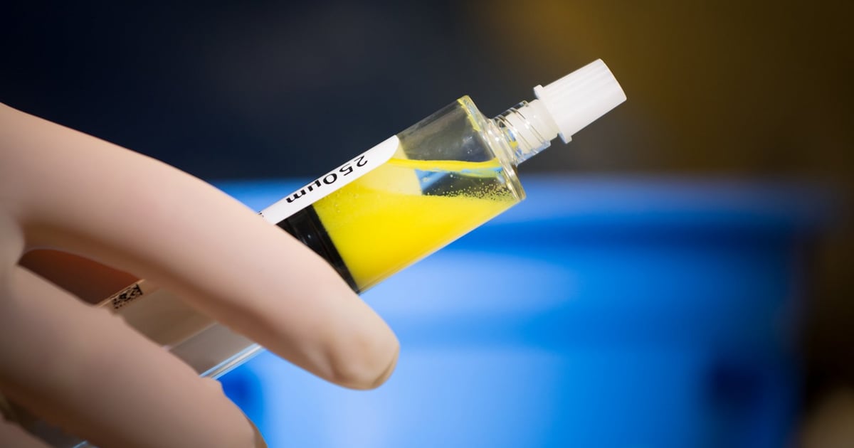 Unsere Eingriffe | Katoh + Schott - interventionelle Radiologie ...