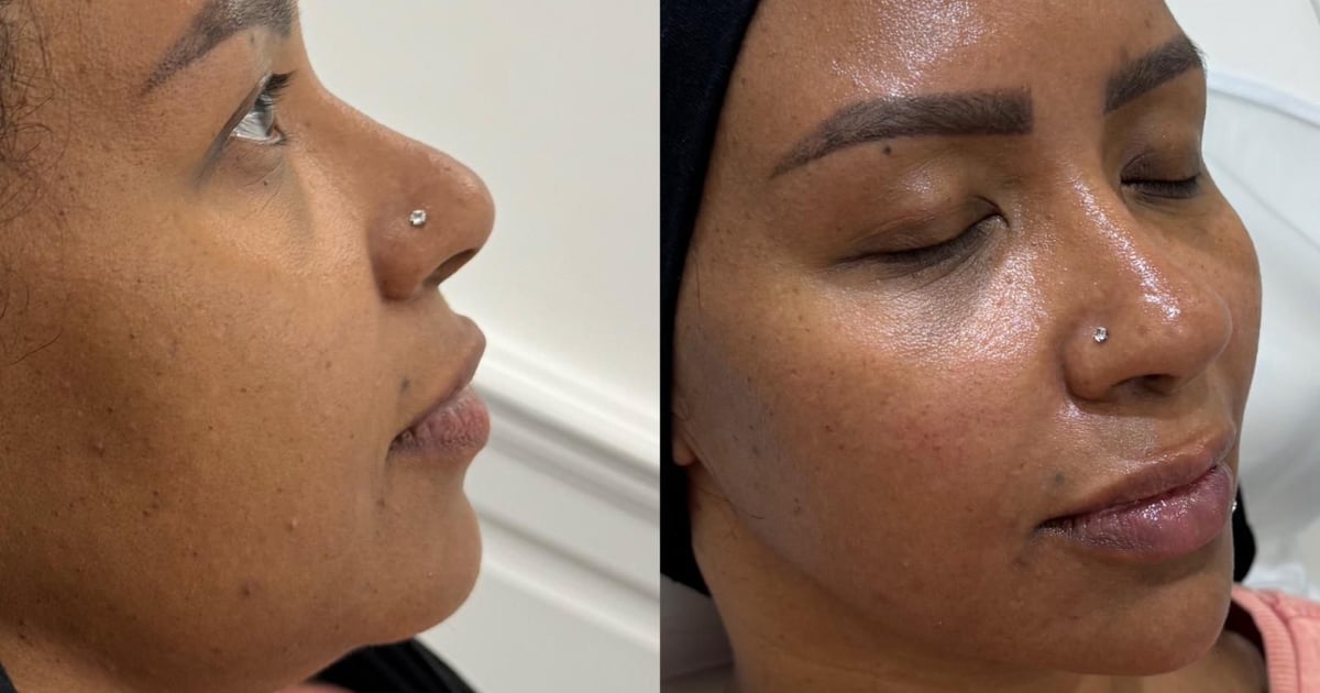 gallery | pure faces london