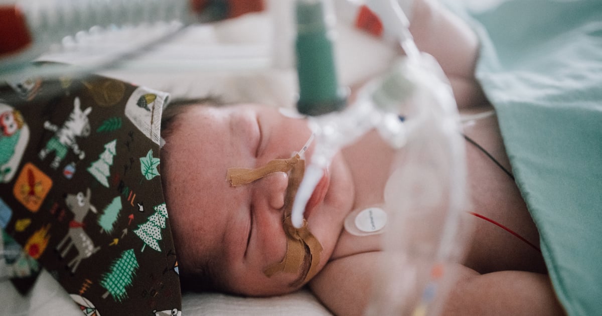 Beatmungsformen - invasive Beatmung - Wissen - Minilöwenblog | Minilöwen